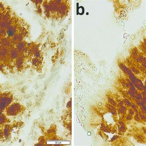 Muc2 Immunostaining In The Proximal A And Distal B Sigmoid Colon