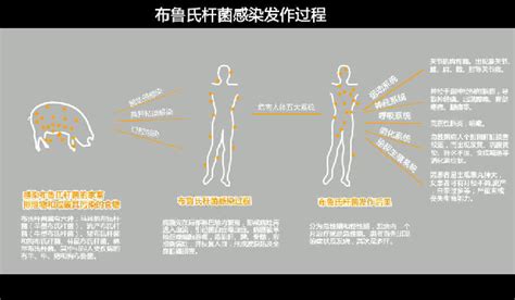 医学史上的5月29日：布鲁氏菌分离者，细菌学家大卫·布鲁斯 大卫·布鲁斯 布鲁氏菌病 细菌学家 健康界