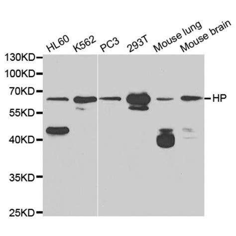Anti Hp Antibody A39197