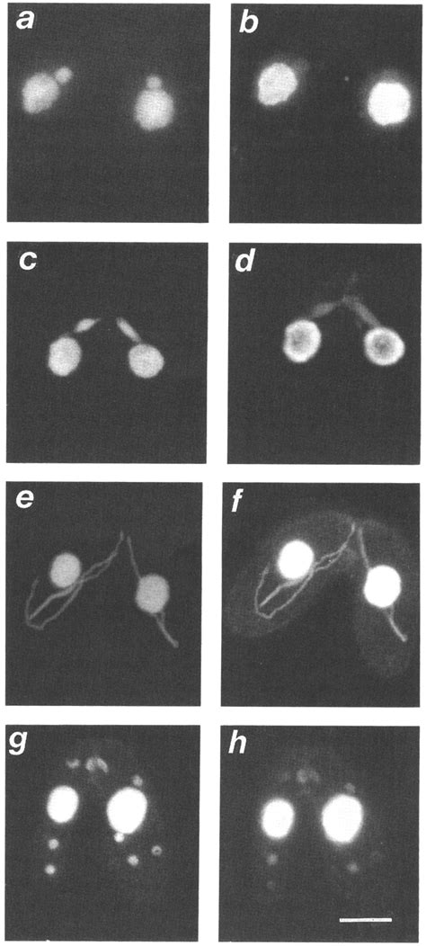 During Conjugation Both Macronuclei And Micronuclei Are Stained With Download Scientific