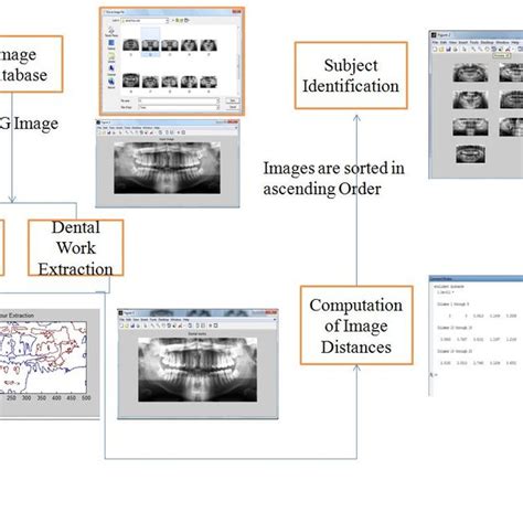 Pdf Human Identification Using Dental Biometrics