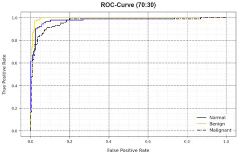 Intelligent Breast Mass Classification Approach Using Archimedes Optimization Algorithm With