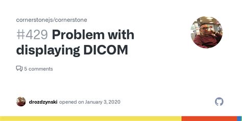problem with displaying dicom · issue 429 · cornerstonejs cornerstone