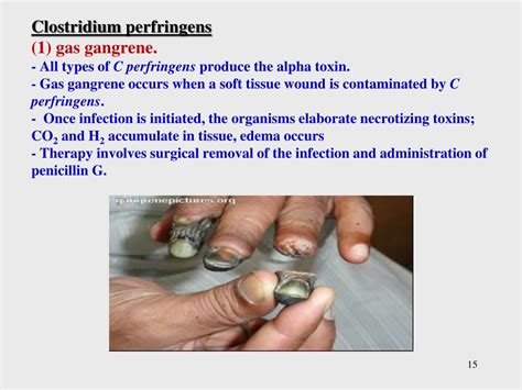 Ppt Gram Positive Rod Dr Hala Al Daghistani Powerpoint Presentation