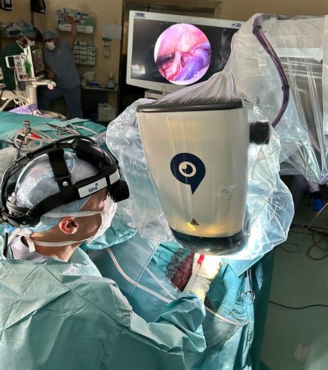 Microvascular Decompression In Trigeminal Neuralgia Using A Robot Microvascular Decompression In Trigeminal Neuralgia Using A Robot