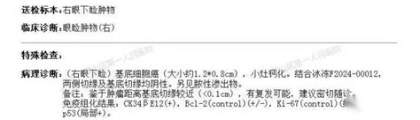 杭州男子脸上一个疤，一查竟是癌，20多年前一次炒菜埋下祸端 知乎