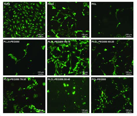 Representative Micrographs Of Adherent Endothelial Cells On The Download Scientific Diagram