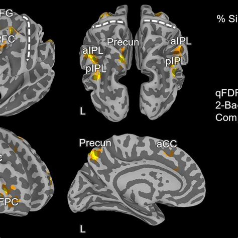 N Back Task Activation Map The Activation Map Ref Lects The Voxel Wise
