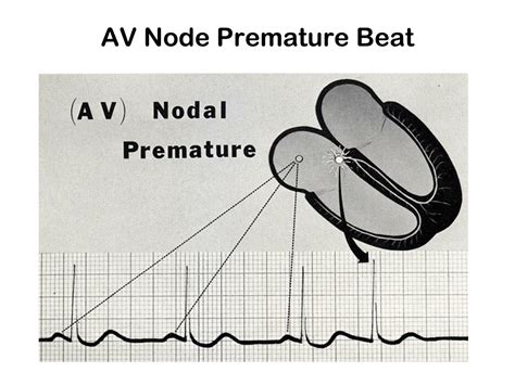 Ppt Expert Guide To Ekg Interpretation Rate Rhythm Hypertrophy