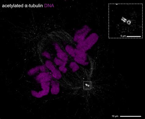 Expansion Microscopy Turns 10 Euro Bioimaging
