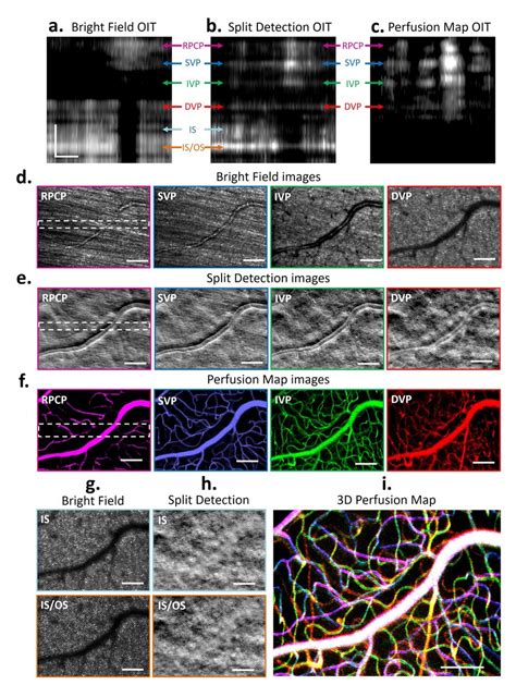 A C Tomographic Retinal Cross Sections Generated By Respectively