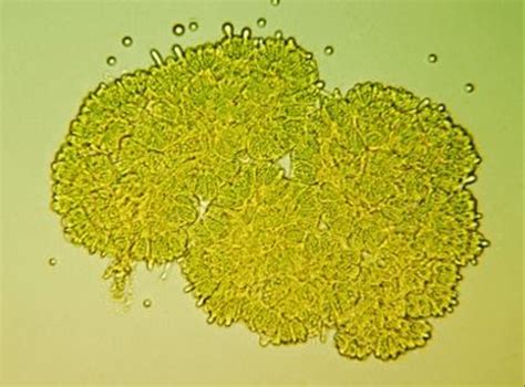 Botryococcus Species With Oil Droplets Download Scientific Diagram