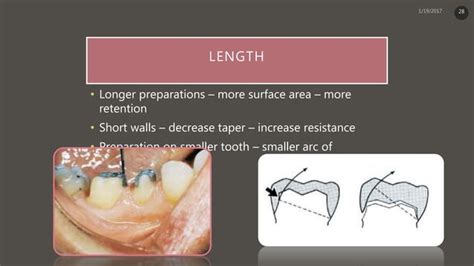 Principle Of Tooth Preparation Pptx Dental Health Diseases And