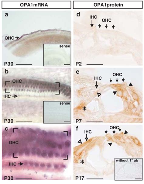 Opa1 Mrna And Protein Expression In The Rat Cochlea Ac Opa1 Mrna Download Scientific Diagram