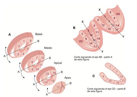 Recordar Los 17 Segmentos En Electrocardiograma Curso