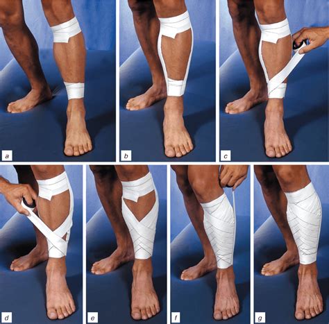Shin Splints Human Kinetics