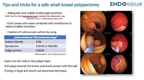 Endocollab™ Gi Endoscopy Education Linkedin‘de The Seven Steps For A Safe Small Bowel