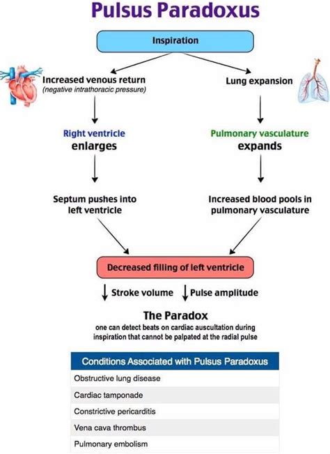 Pulsus Paradox Drmohammed Ashraf