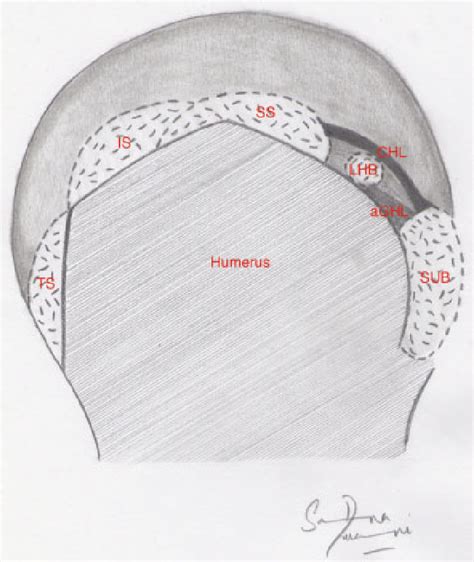 Rotator Cuff And Rotator Interval Anatomy Sagittal Section Of The Download Scientific Diagram
