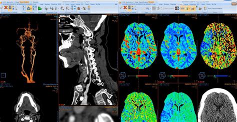 Philips Vue Pacs Package 25k Basic Pt Aneka Medika Indonesia