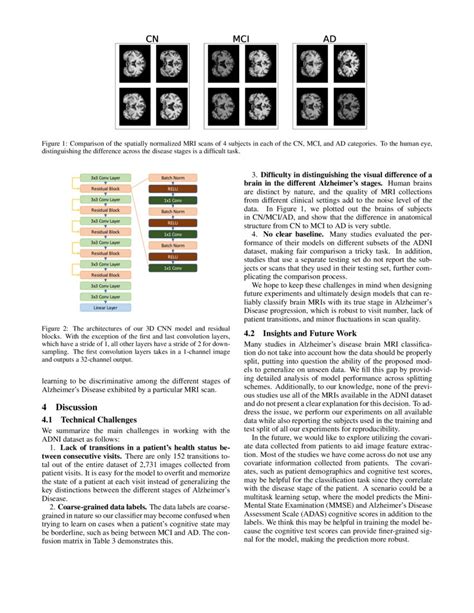 Alzheimers Disease Brain Mri Classification Challenges And Insights Deepai