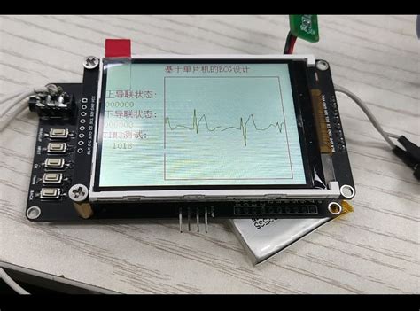 基于gd32f103单片机ad8232的心电监护系统设计 Stm328