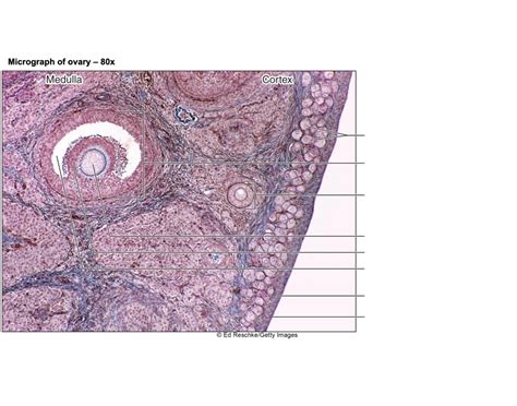 Ovary Micrograph Quiz
