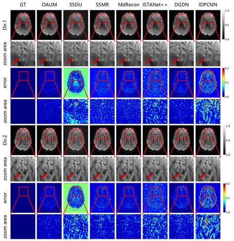The Dwi Results Reconstructed From Models With Acceleration Factor Af Download Scientific