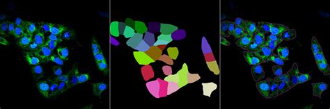 Cell By Cell Nuclear Cytoplasm Intensity Ratio Measurement Image Analysis Image Sc Forum