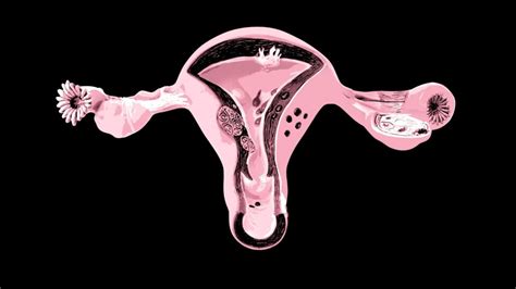 Hair Relaxer Ovarian Cancer Lawsuit — Lawsuit Information Center