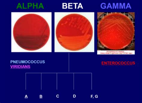 7 Streptococci Flashcards Quizlet
