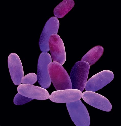 Halobacterium Salinarum BiologÍa Y GeologÍa