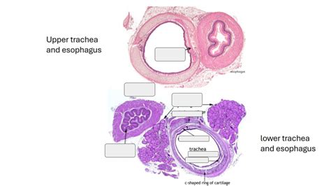 Trachea And Esophagus Histology Diagram Quizlet