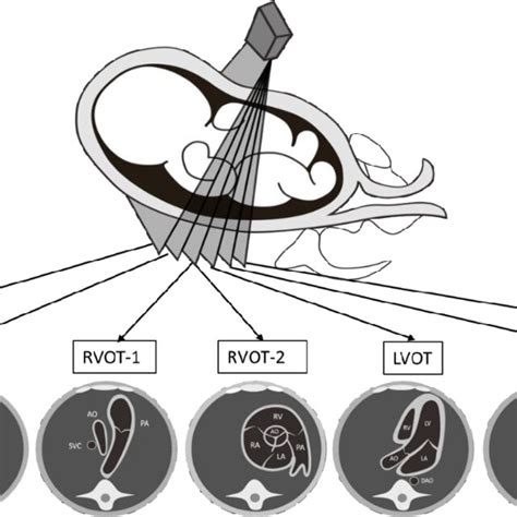 Six Fetal Cardiac Ultrasound Image Views Where The Main Anatomical