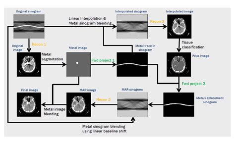 Metal Artifact Reduction Algorithm For Single Energy And Dual Energy Ct Scans Semantic Scholar