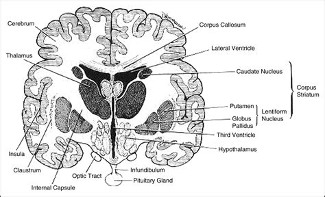 Interthalamic Adhesion