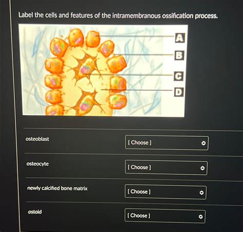 Solved Label The Cells And Features Of The Intramembranous