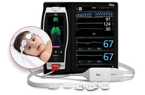 Root Platfor Neo Masimo Медичне Обладнання КСЕНКО