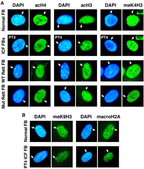 The Interphase Inactive X In Normal And Mutant Cells Histone
