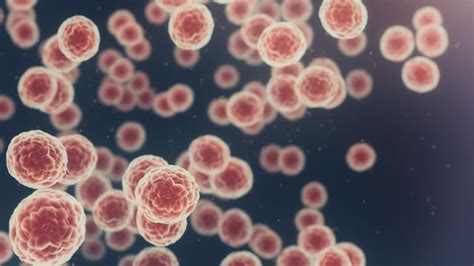 Key Mutation In Osteosarcoma Progression Discovered Technology Networks