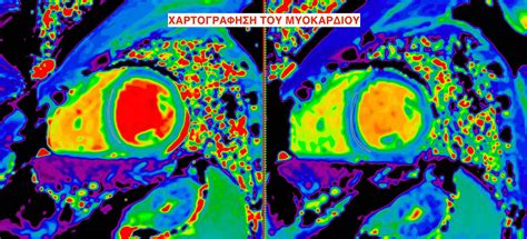 Cmr Mapping Βιδαλάκης Ελευθέριος
