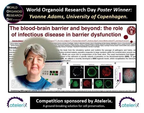 13 Apr The 3d Round Up Organoid Spheroid And Organ On A Chip News Worc Community