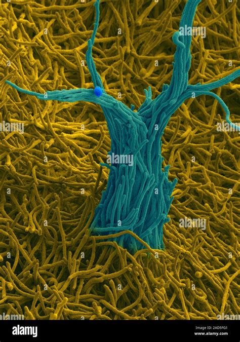 Coloured Scanning Electron Micrograph Sem Of Exophiala Spinifera Is A Dermatiaceous Fungus