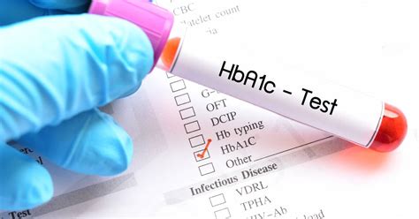 What Is A Dangerous Level Of A1c Diabetes Strong