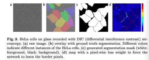 【论文阅读】u Net：convolutional Networks For Biomedical Image Segmentation《u