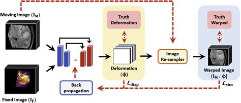 The Workflow Of The Proposed Deformable Magnetic Resonance Download Scientific Diagram