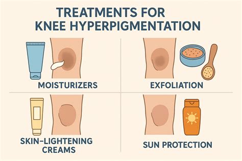 Cheek Acne Causes And Dermatologist Approved Treatments