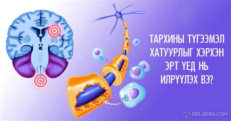 Тархины түгээмэл хатуурал ихэвчлэн залуучуудад тохиолддог өвчин