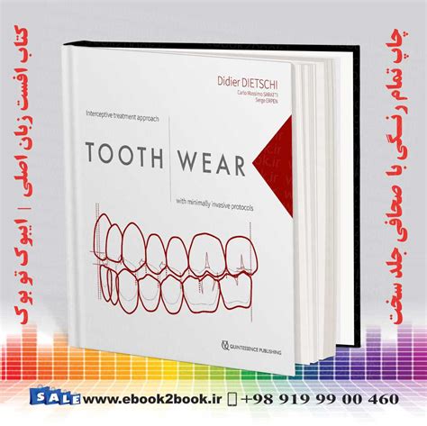 Tooth Wear Interceptive Treatment Approach With Minimally Invasive Protocols فروشگاه کتاب