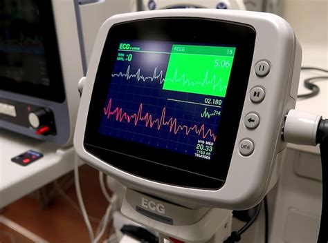 sleek ecg machine showing realtime heart rate data premium ai
